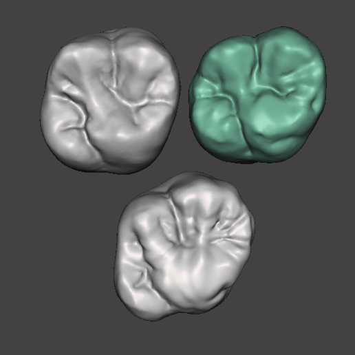 Anatomía Del Premolar Maxilar Elevación Del Piso Del Seno Máxilar