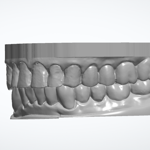 🦷 Modèle d'arcade dentaire complète supérieure et inférieure avec ...