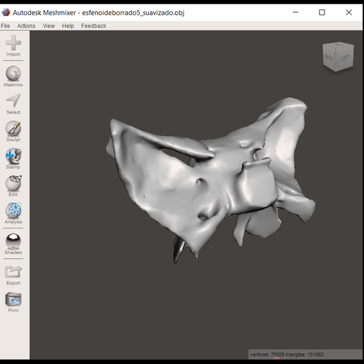sphenoid bone 3d