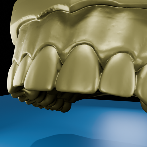 Printable Upper Dental Arch / Teeth Model 🦷 (Anatomy Study)・ STL File ...