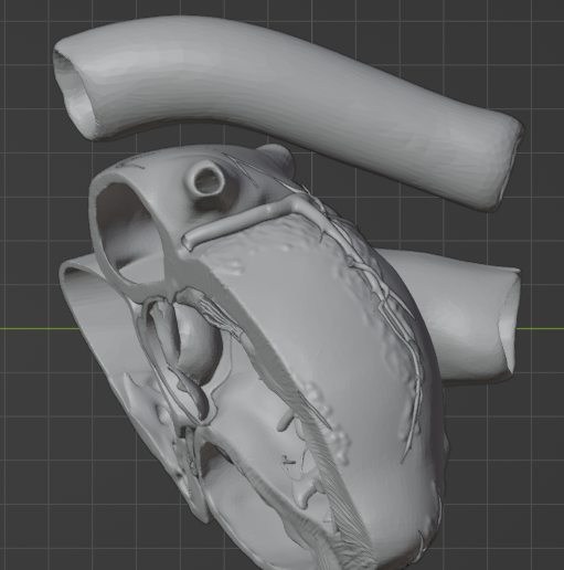 💜 3D Model of Heart (2.3.4.5 chamber view) - 4 pack・ STL File for ・Cults