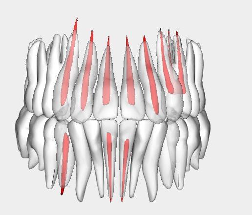 🦷 Teeth with roots・ STL File for 3D printing・Cults