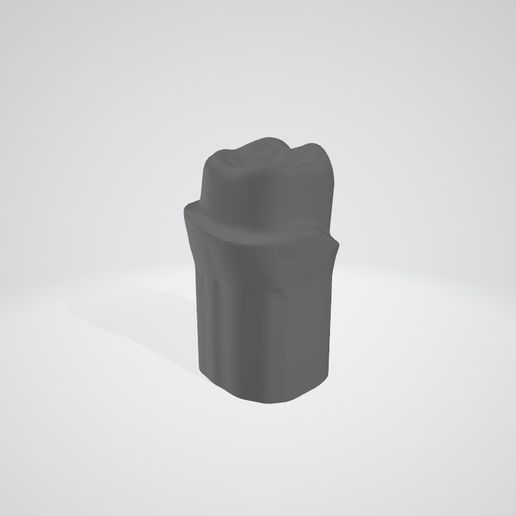 arquivo 3D Lower Dental Abutment with Matching Crown - 3D Printable ...