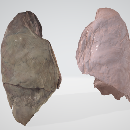 STL file REAL LUNG ANATOMY WITH DETAILED HILUM, BRONCHUS, PULMONARY ...