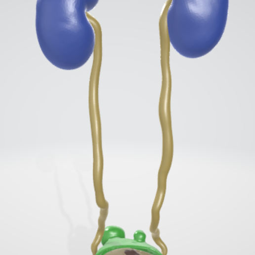 ♂️ 6 PARTS 3D Benign prostatic hyperplasia with complications ...