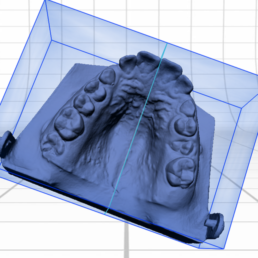 🩻 SUPERIOR MAXILLARY from Intraoral Scan - AREA3D- Patient A. TOP ...