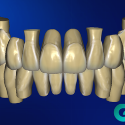 3D file "RAINBOW" Tooth library exocad 🌈 ・3D printable model to ...