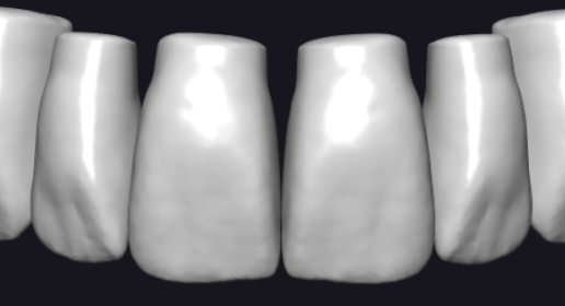 STL file Zirkonzahn Exocad Tooth library 🦷 ・3D printable model to ...