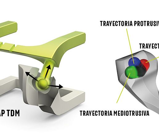 3D file Xsnap ARTICULATOR 2.0 TDM 🦷 ・3D printing model to download・Cults