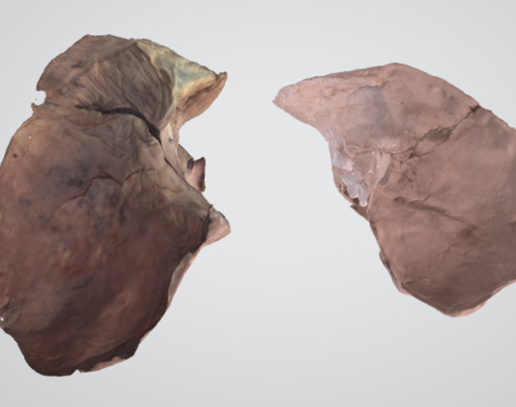 STL file REAL LUNG ANATOMY WITH DETAILED HILUM, BRONCHUS, PULMONARY ...