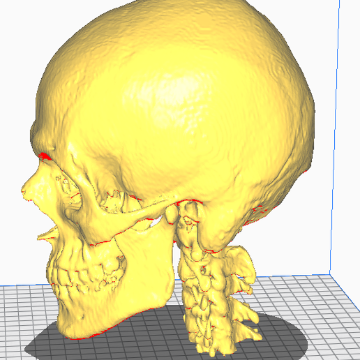 STL file Human skull CT scan 💀 ・3D printer design to download・Cults