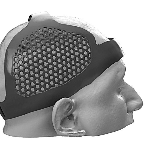 🪖 Helmet For Post Cranioplasty・ STL File for 3D printing・Cults