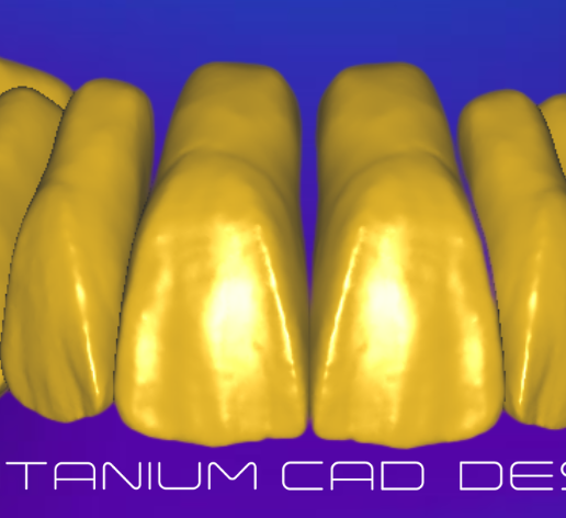 STL file TITANIUM CAD Exocad Tooth library 🦷 ・Template to download and ...
