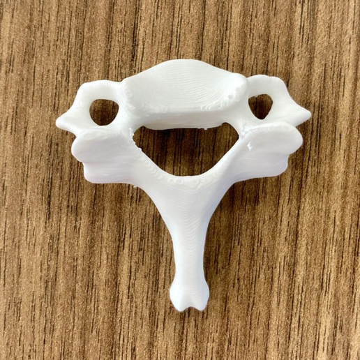 3d printed vertebrae