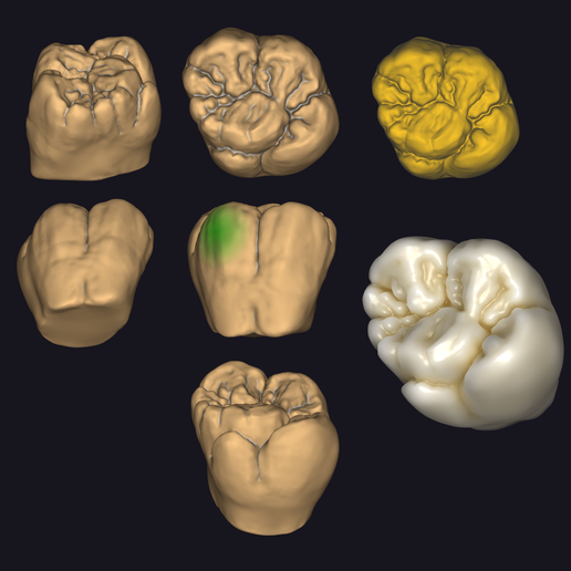 🦷 Maxillary Molar Sculpt・ STL File for 3D printing・Cults