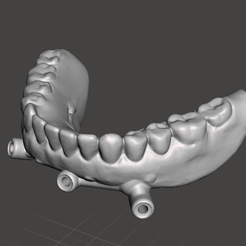 STL file All-on-4 Mandible Scan/Escaneo de mandibula NEODENT 🦷 ・3D ...