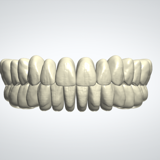 😇 3Shape Smile Library Halo 8・ STL File for 3D printing・Cults
