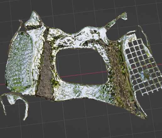 🦷 Prosthodontics Kennedy Class II Mod 1 Removable Partial Dentures ...