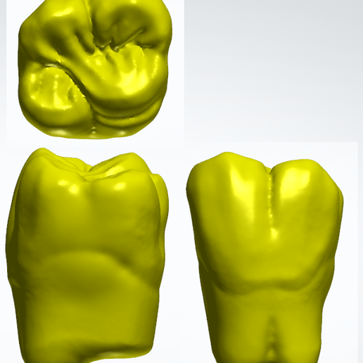 🦷 Maxillary First Molar・ STL File for ・Cults