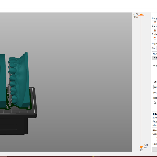 STL file Digital Orthodontic Study Models with Virtual Bases 🧑‍🏫 (OBJ ...