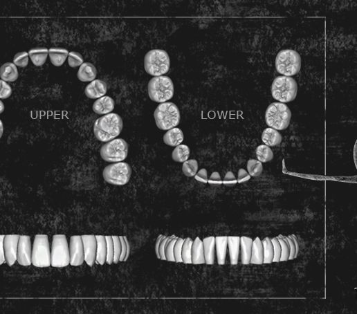 STL file Zirkonzahn Exocad Tooth library 🦷 ・3D printable model to ...