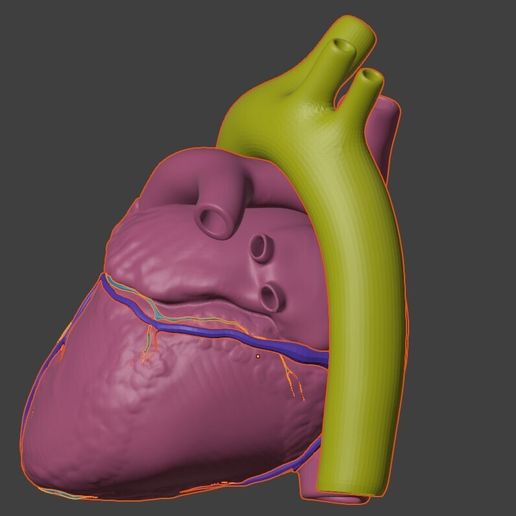 STL file 3D Model of Heart with Double Outlet Right Ventricle 💜 ・3D ...