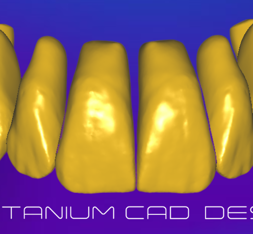 STL file TITANIUM CAD Exocad Tooth library 🦷 ・Template to download and ...