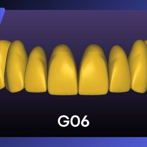 3D file V.I.P Collection For exocad ( Vip tooth library over 400 ...