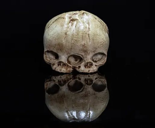 💀 Conjoined Fetal Skull・ 3D File for 3D printing・Cults