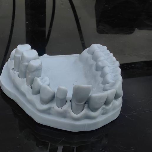 🦷 dental models (geller type)・Archivo STL para Impresión 3D・Cults