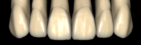 Archivo STL Orlando Giraldo Exocad Tooth library 🦷 ・Modelo para ...