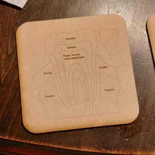 🦷 tooth parts・ 3D File for CNC machining - Laser cutting・Cults