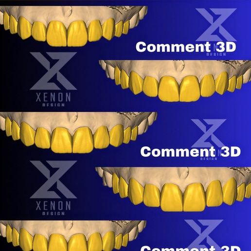 🎨 Xenon Teeth Libraries・ 3D File for 3D printing・Cults