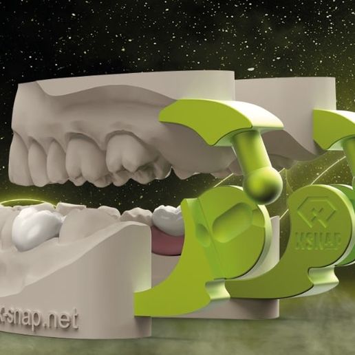 3D file xSnap Gen 2 for EXOCAD 🐉 ・3D printable model to download・Cults