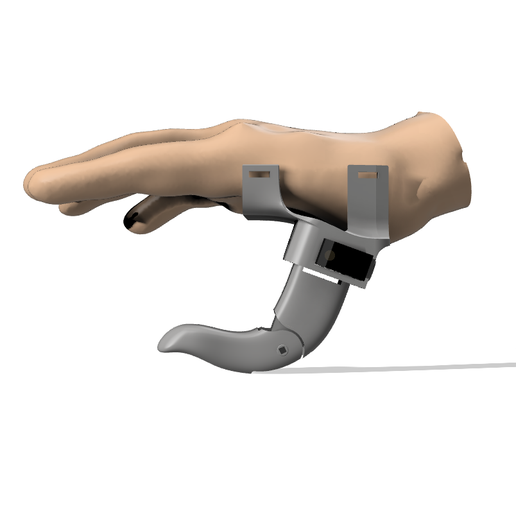 ️ Low Cost Professional Prosthesis with robotic thumb for amputed right ...