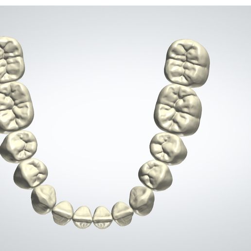 🩻 3Shape OPEN Library AP_Natural・ 3D File for 3D printing・Cults