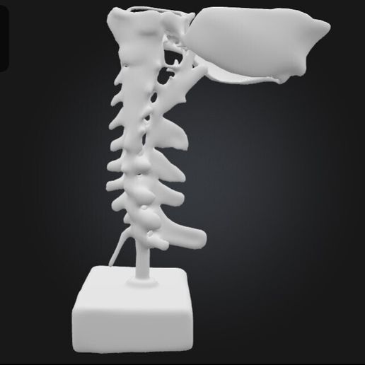 STL file 3D Model of Cervical Vertebral Column with Spinal Nerves and ...