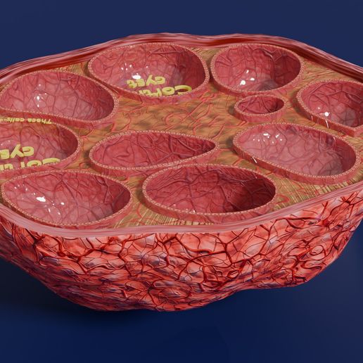 ⚕️ Polycystic Ovary Disease PCOD・ STL File for 3D printing・Cults