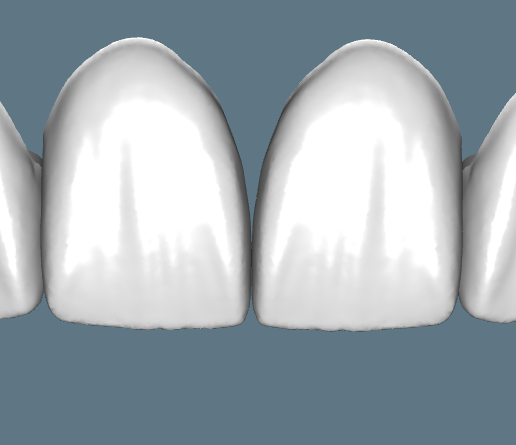 STL file Da Vinci Exocad Tooth library 🦷 ・3D printer design to download ...
