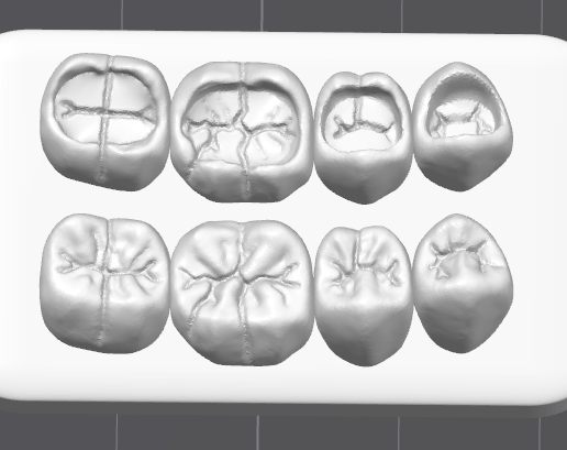 🩻 Occlusal Restoration Training Models Upper Lower・ 3D File for 3D ...