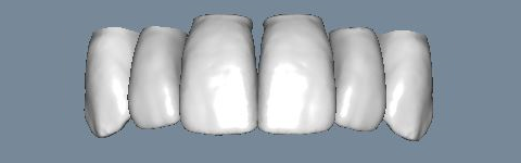 STL file Zirkonzahn Exocad Tooth library 🦷 ・3D printable model to ...