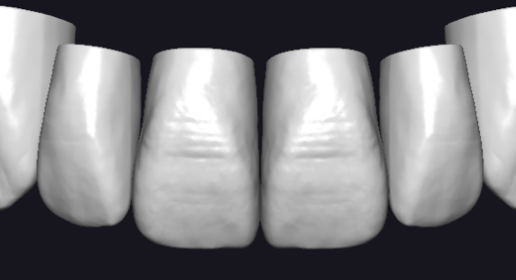 STL file Gebdi Tribos Exocad Tooth library 🦷 ・3D printing idea to ...