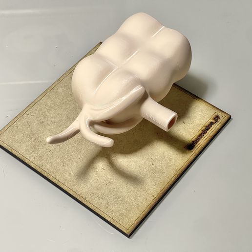 🩻 Appendix position anatomy・ STL File for 3D printing・Cults
