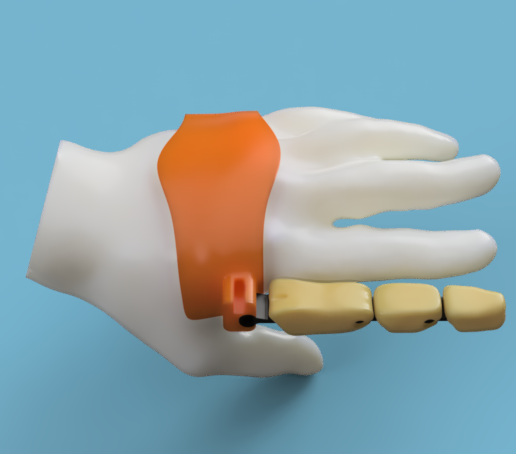 🩻 Prótesis dedo /finger prosthesis・Archivo 3MF Gratis para Impresión 3D ...