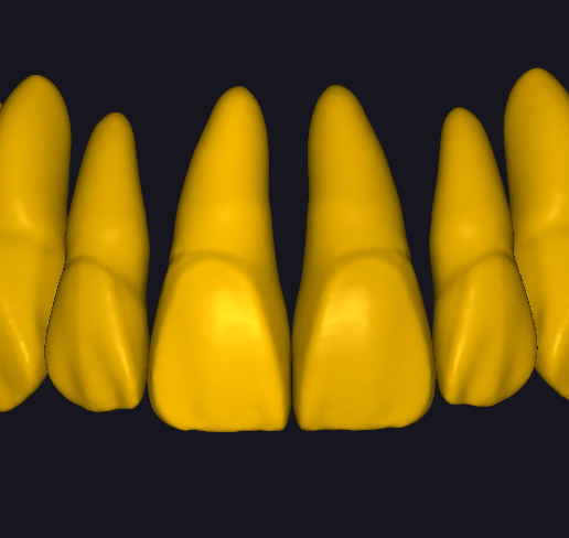 STL file GRIN DESIGN 2025 NEW Exocad Tooth library 🆕 ・Model to download ...