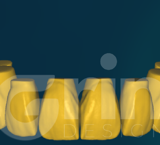 STL file GRIN DESIGN 2024 New Exocad Tooth library 🆕 ・Model to download ...