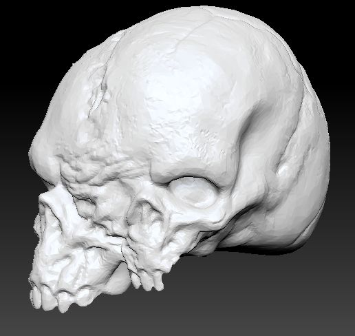 deformed skull