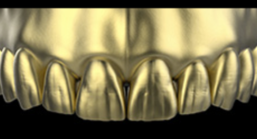 👑 The complete set of 36 'Expression' dental libraries - Exocad・ STL ...