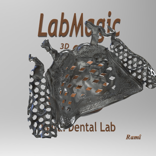 🖼️ Digital RPD Frame (Partial Denture)・ STL File for ・Cults