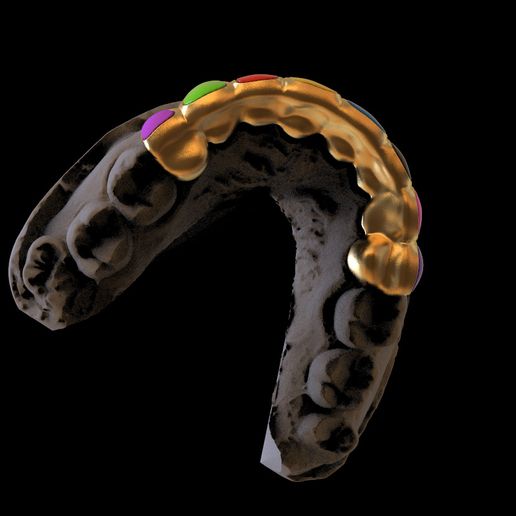 💀 grillz 3D print model・ STL File for ・Cults